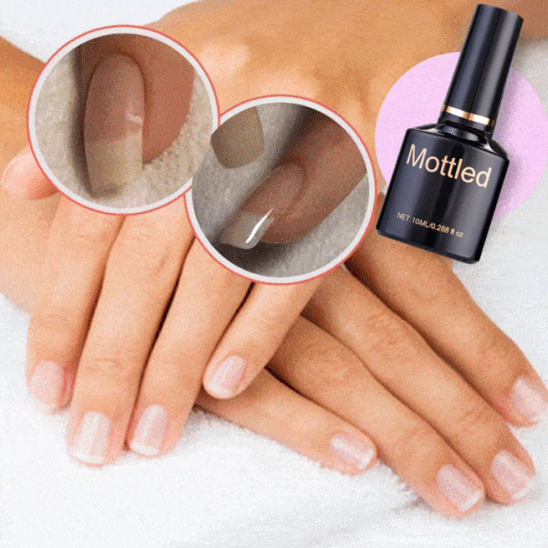 Mottled Nail™ - Fórmula Reconstructiva – Royal Shop